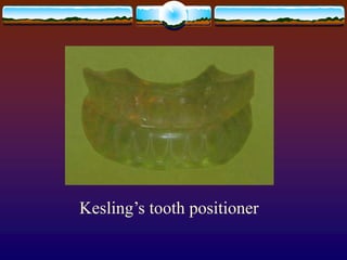 RETENTION AND RELAPSE O.ppt