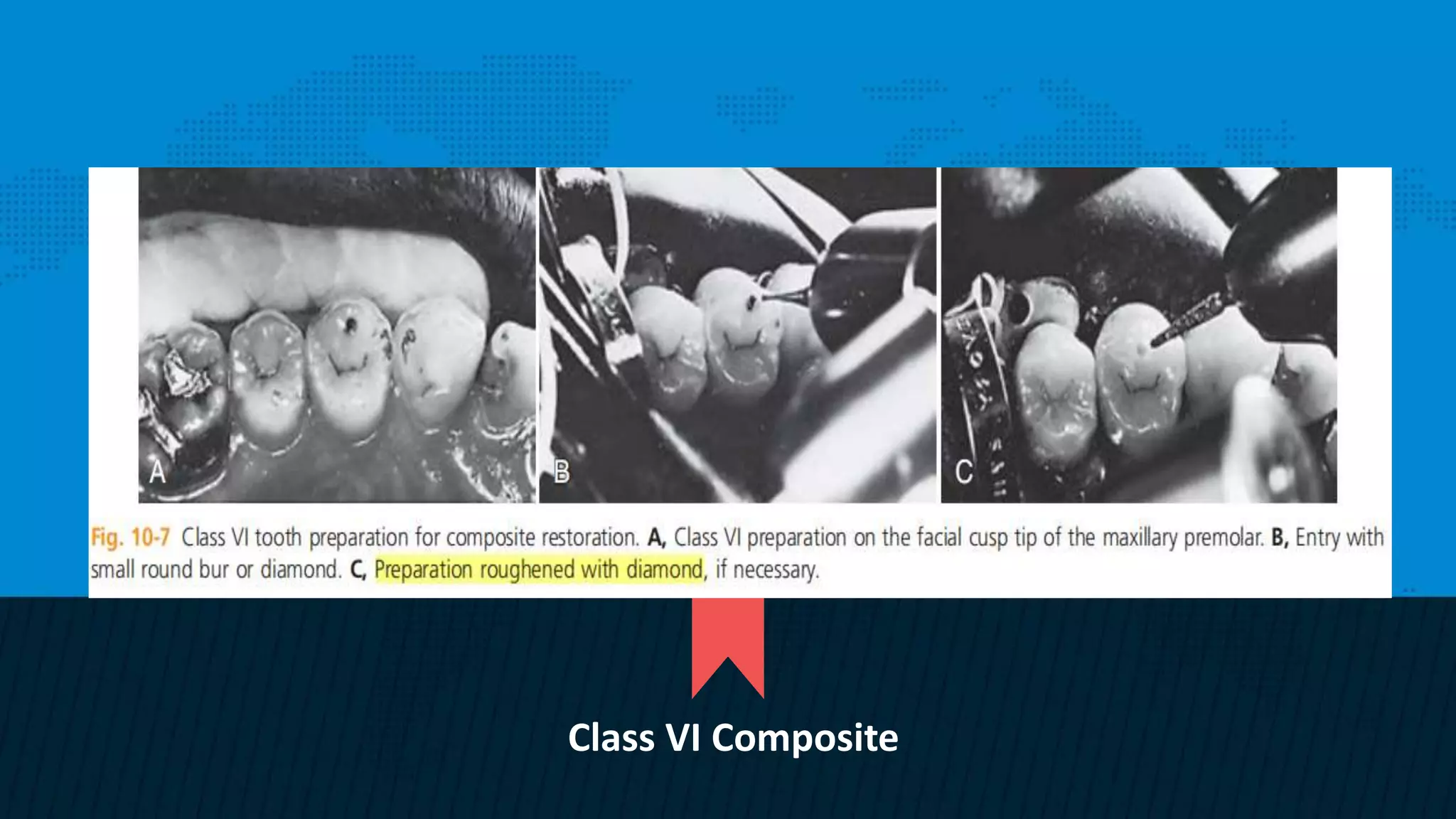 Retention and resistance forms of cavity design | PPTX