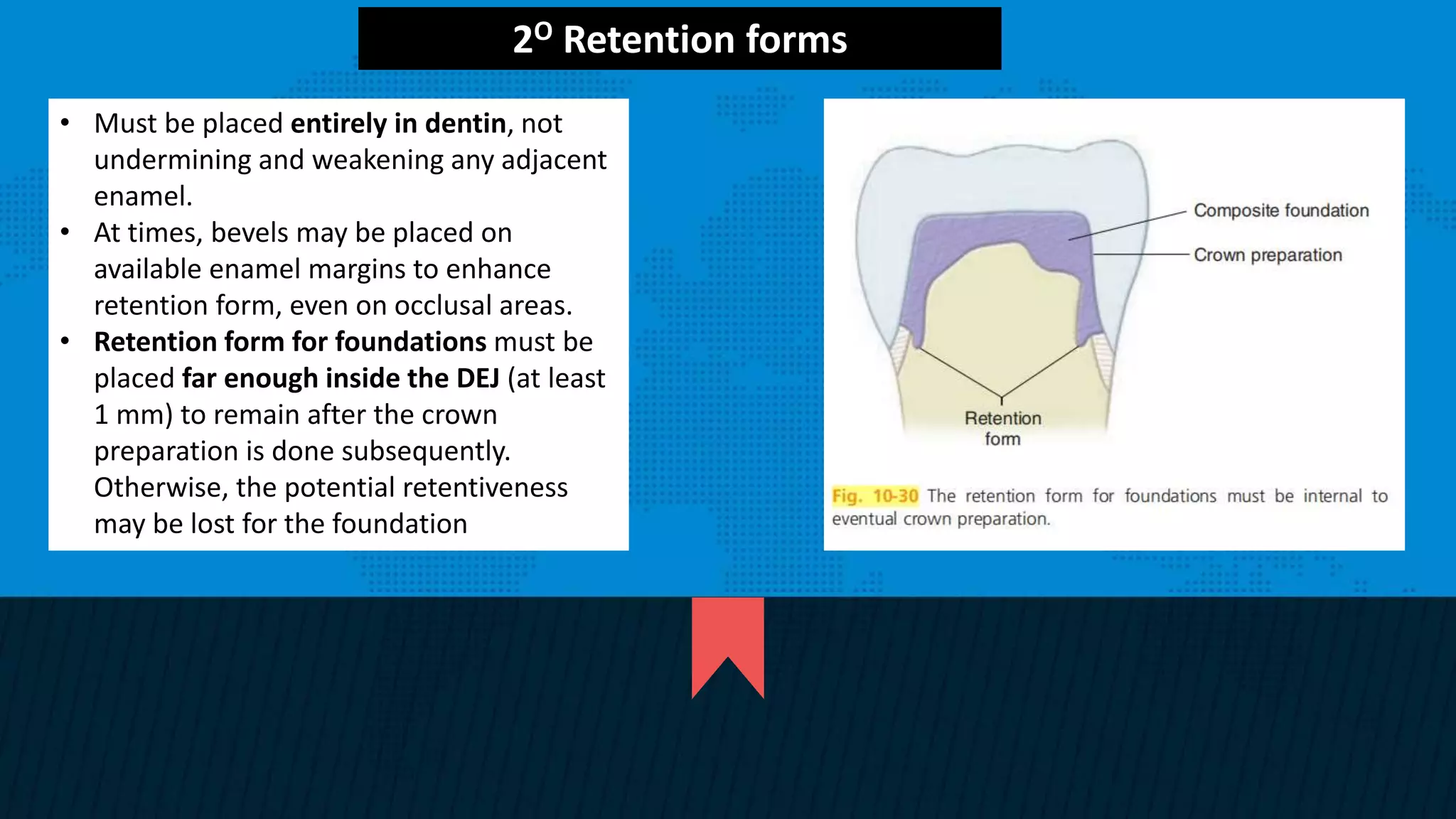 Retention and resistance forms of cavity design | PPTX