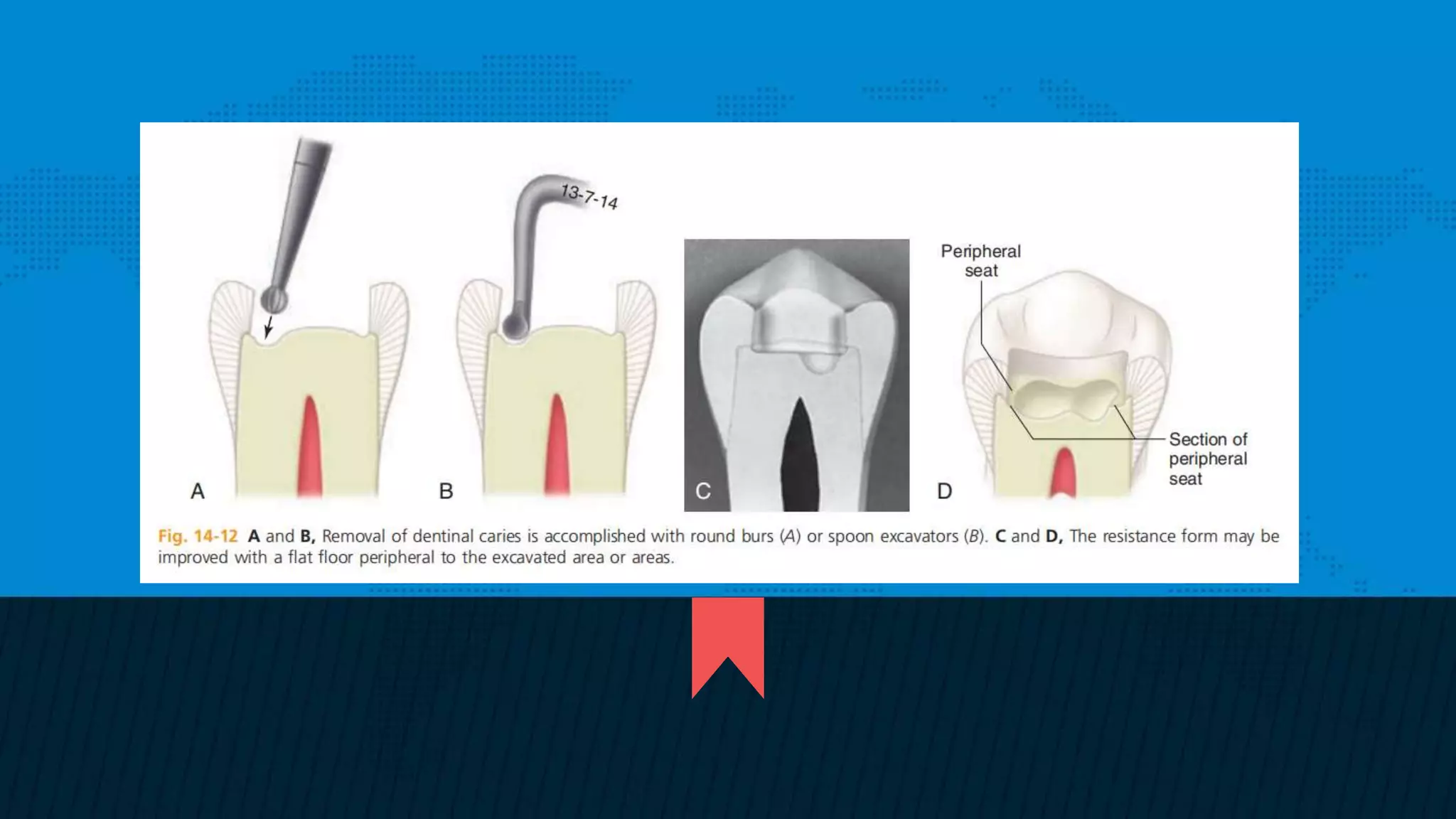 Retention and resistance forms of cavity design | PPTX