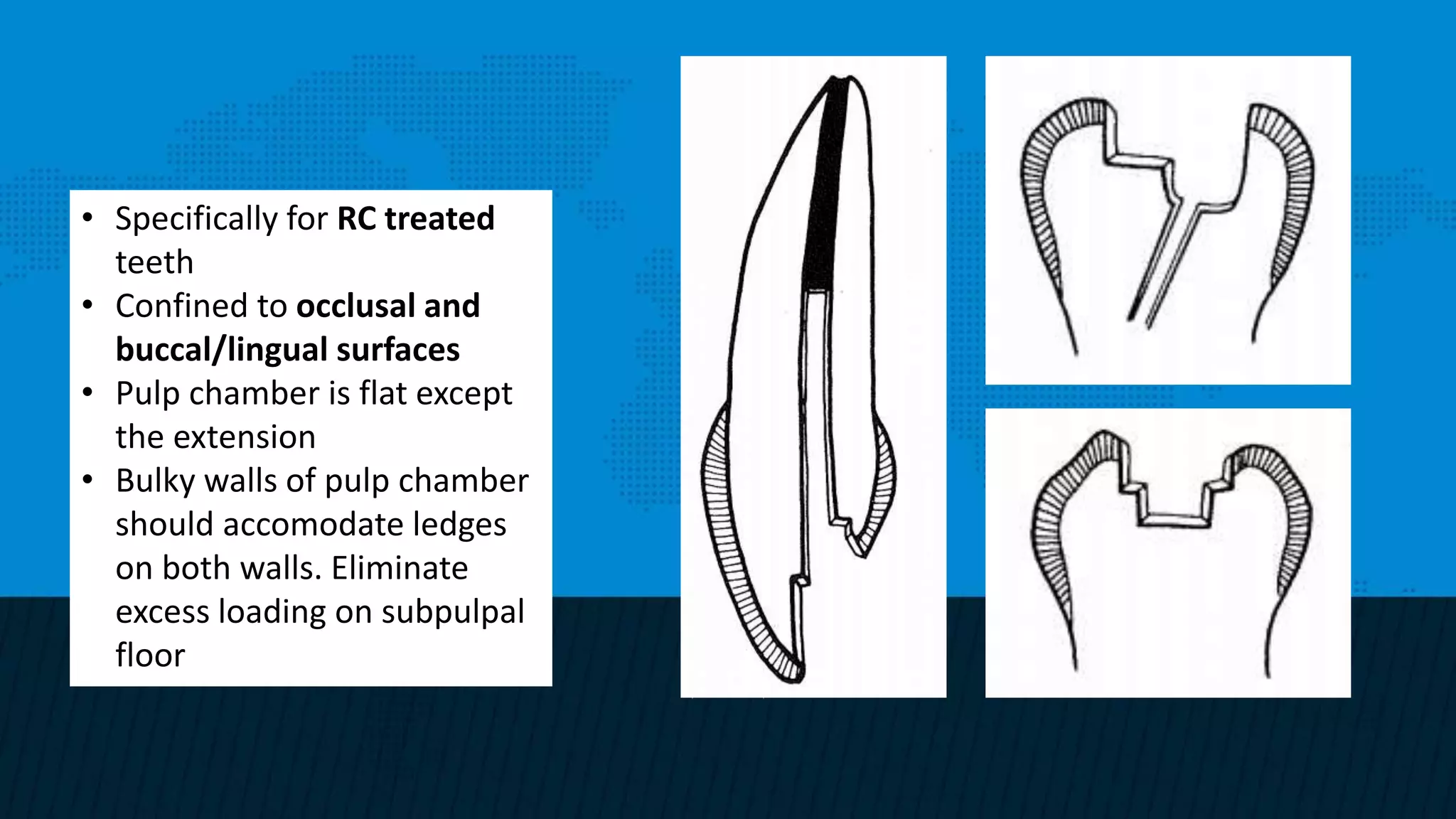 Retention and resistance forms of cavity design | PPTX