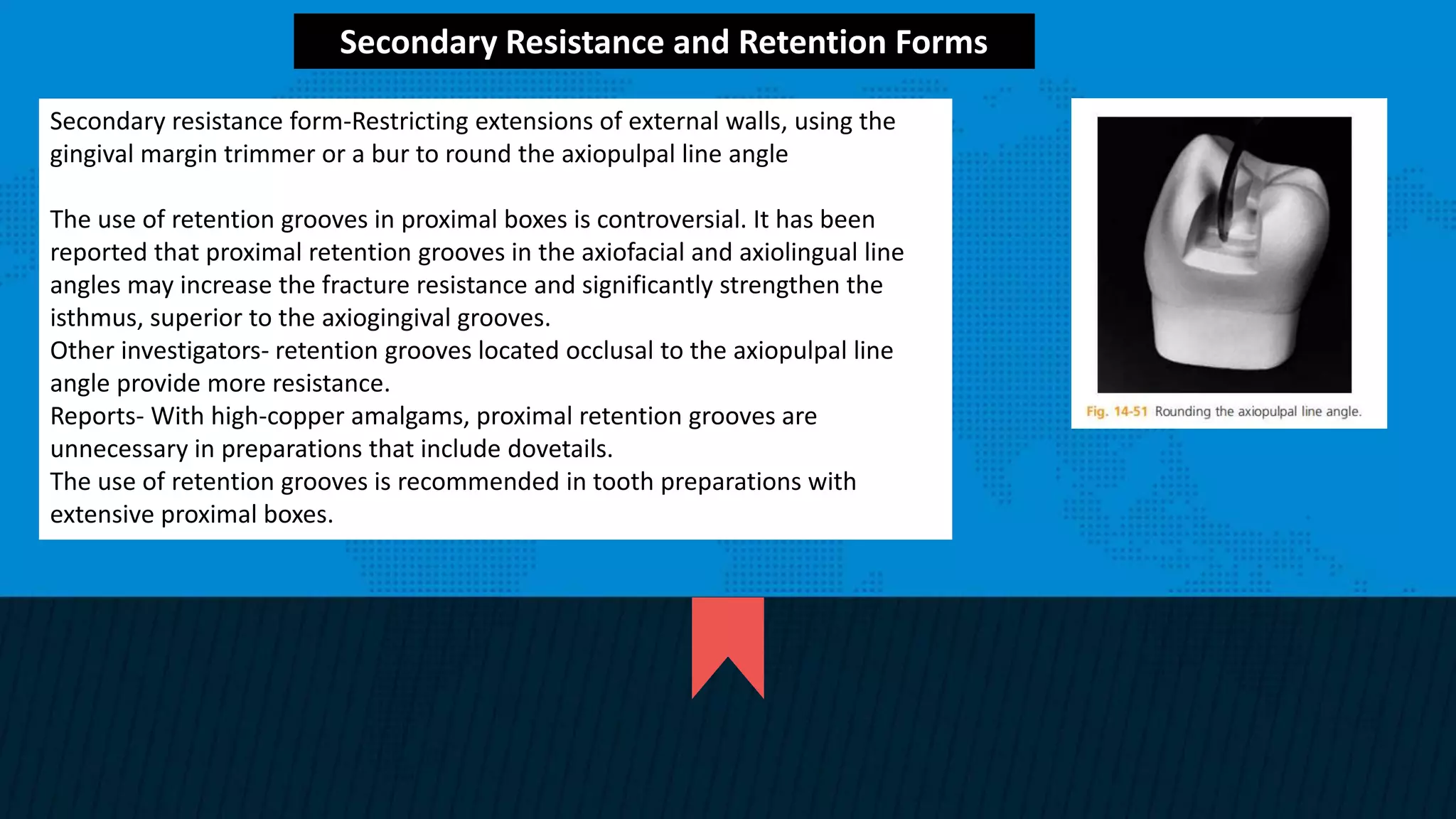 Retention and resistance forms of cavity design | PPTX