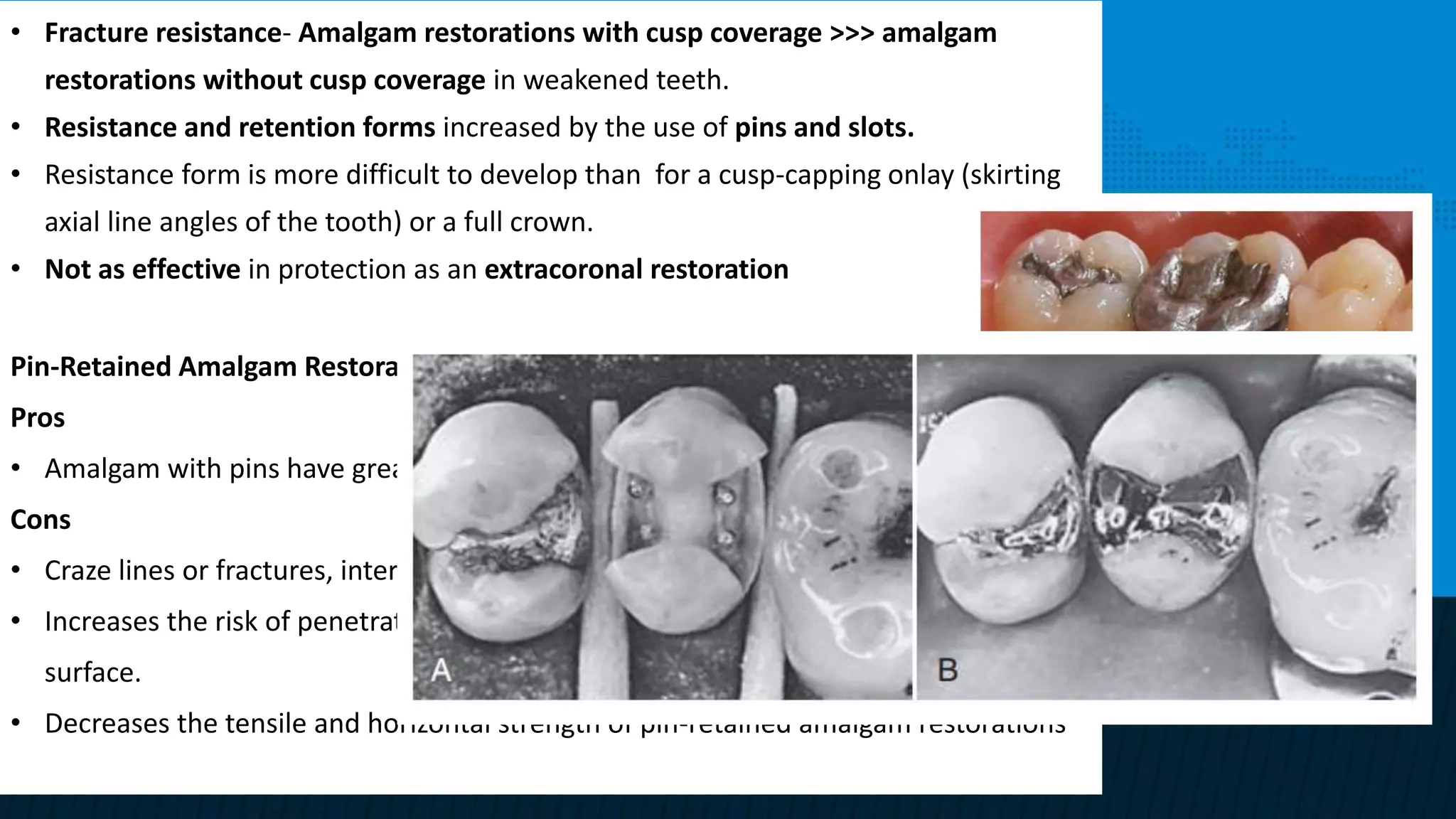 Retention and resistance forms of cavity design | PPTX