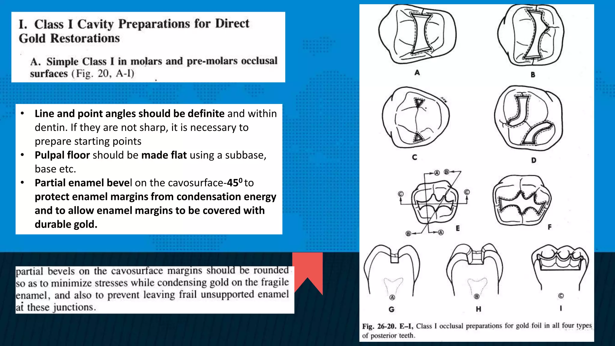 Retention and resistance forms of cavity design | PPTX
