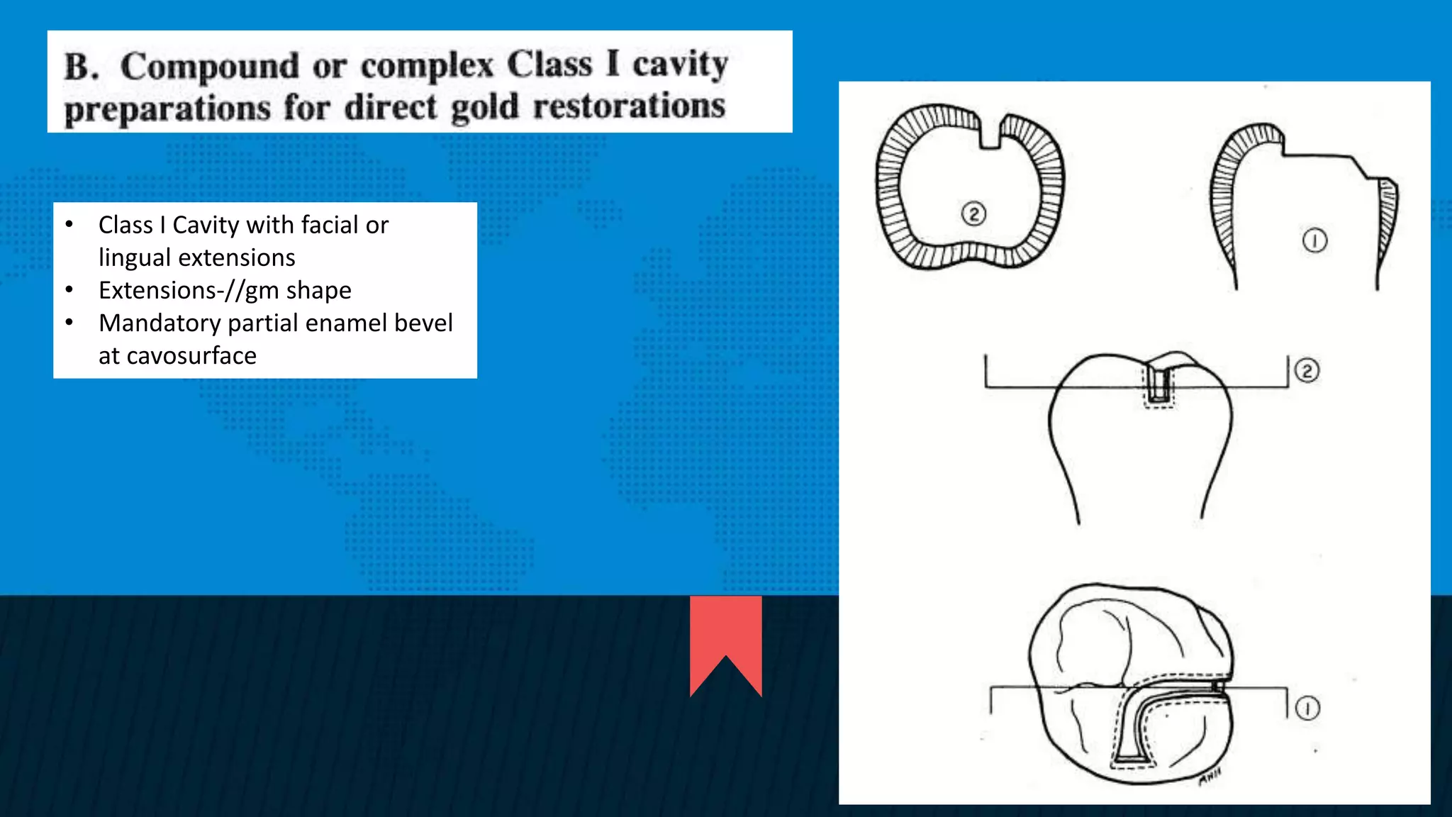 Retention and resistance forms of cavity design | PPTX
