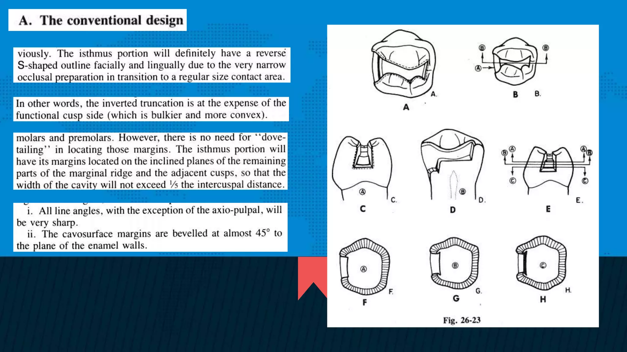 Retention and resistance forms of cavity design | PPTX