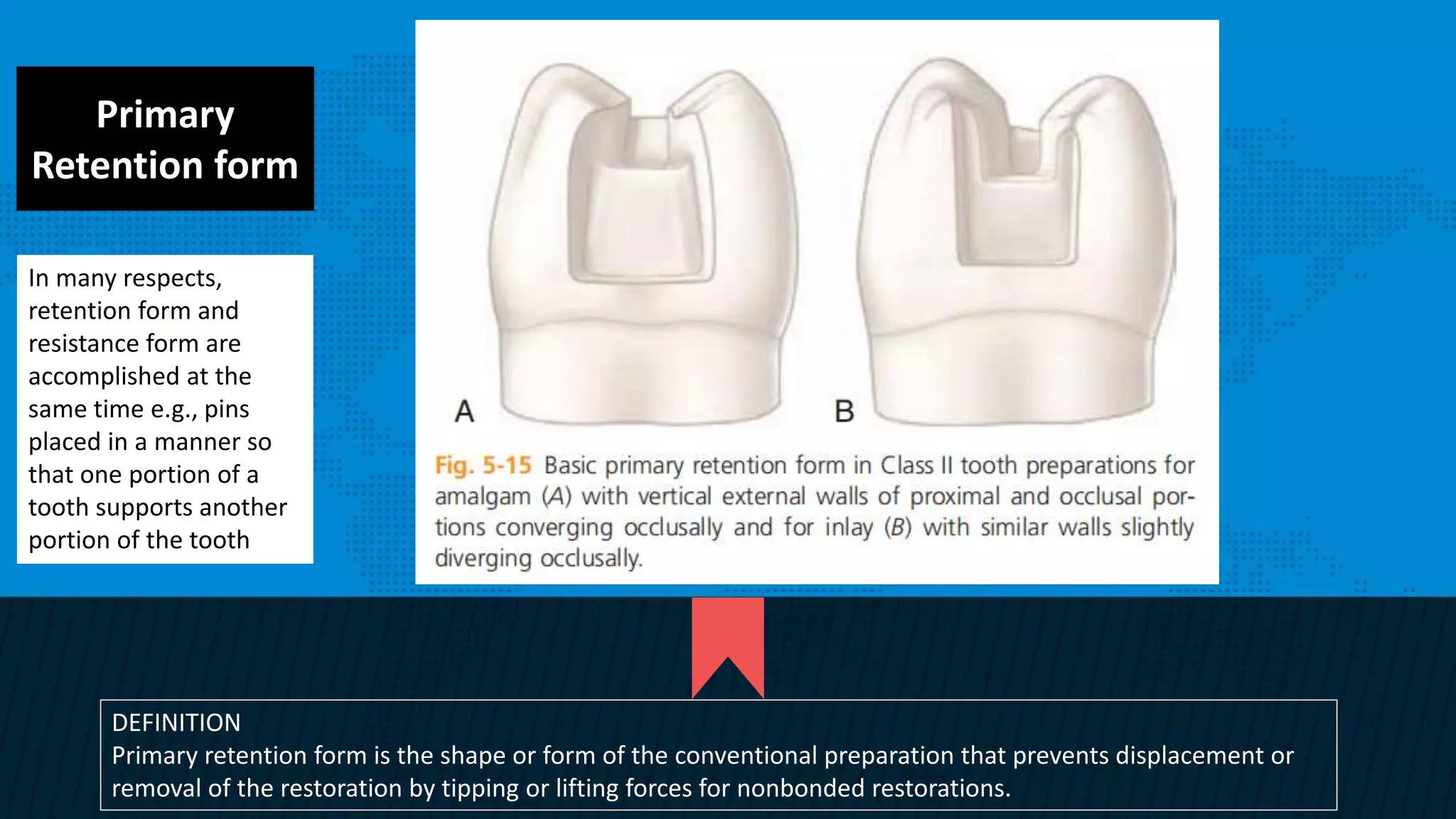Retention and resistance forms of cavity design | PPTX