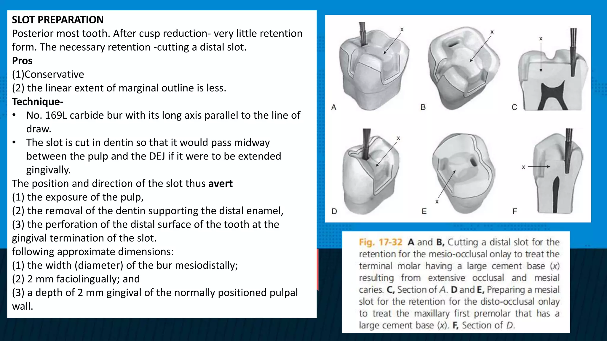 Retention and resistance forms of cavity design | PPTX