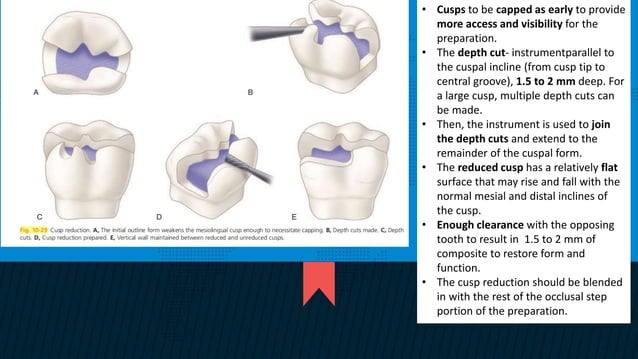 Retention and resistance forms of cavity design | PPTX | Dental Health ...
