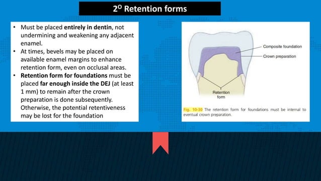 Retention and resistance forms of cavity design | PPTX | Dental Health ...