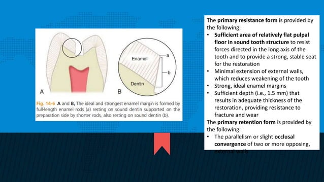 Retention and resistance forms of cavity design | PPTX | Dental Health ...