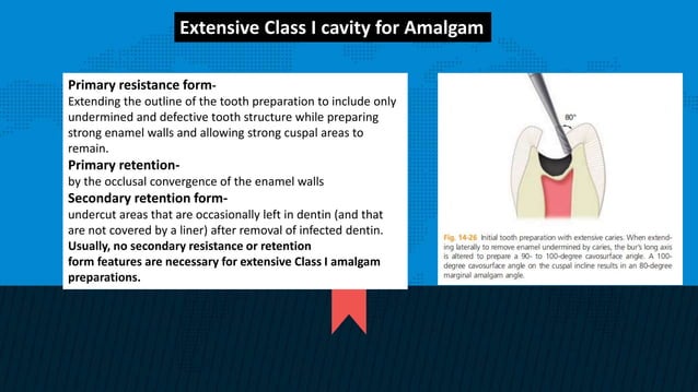 Retention and resistance forms of cavity design | PPTX | Dental Health ...