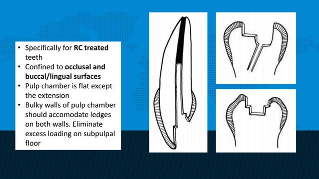 Retention and resistance forms of cavity design | PPTX | Dental Health ...