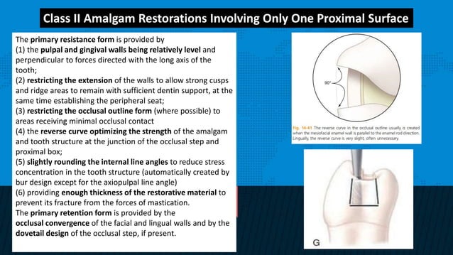 Retention and resistance forms of cavity design | PPTX | Dental Health ...