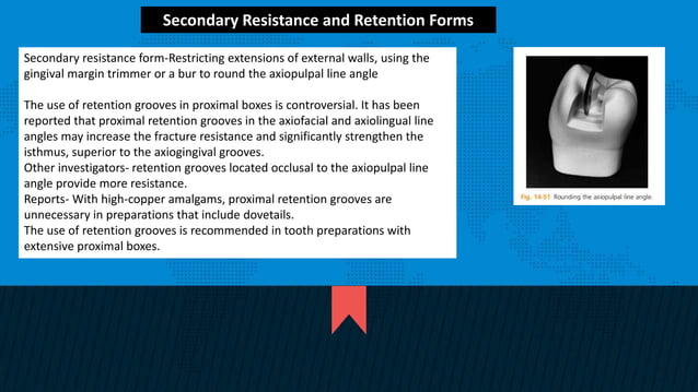 Retention and resistance forms of cavity design | PPTX | Dental Health ...