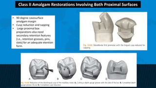 Retention and resistance forms of cavity design | PPTX