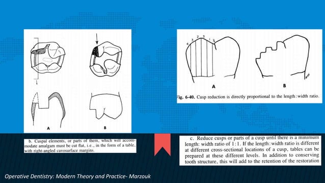Retention and resistance forms of cavity design | PPTX | Dental Health ...