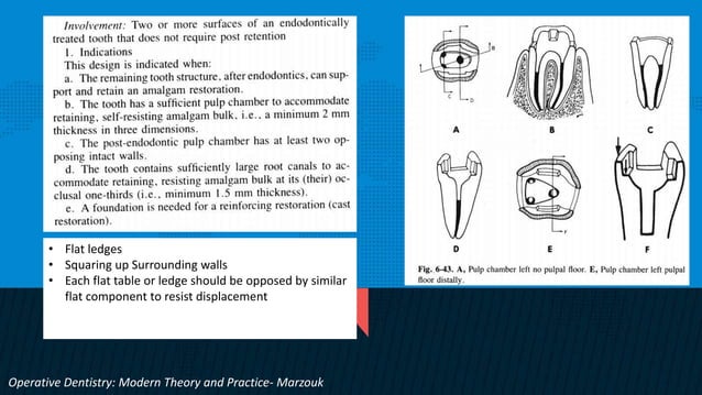 Retention and resistance forms of cavity design | PPTX | Dental Health ...