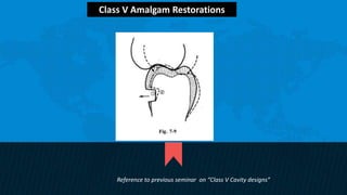 Retention and resistance forms of cavity design | PPTX
