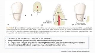 Retention and resistance forms of cavity design | PPTX