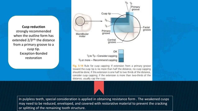 Retention and resistance forms of cavity design | PPTX | Dental Health ...