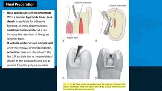 Retention and resistance forms of cavity design | PPTX
