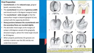 Retention and resistance forms of cavity design | PPTX