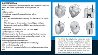 Retention and resistance forms of cavity design | PPTX