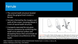 Retention and resistance forms of cavity design | PPTX