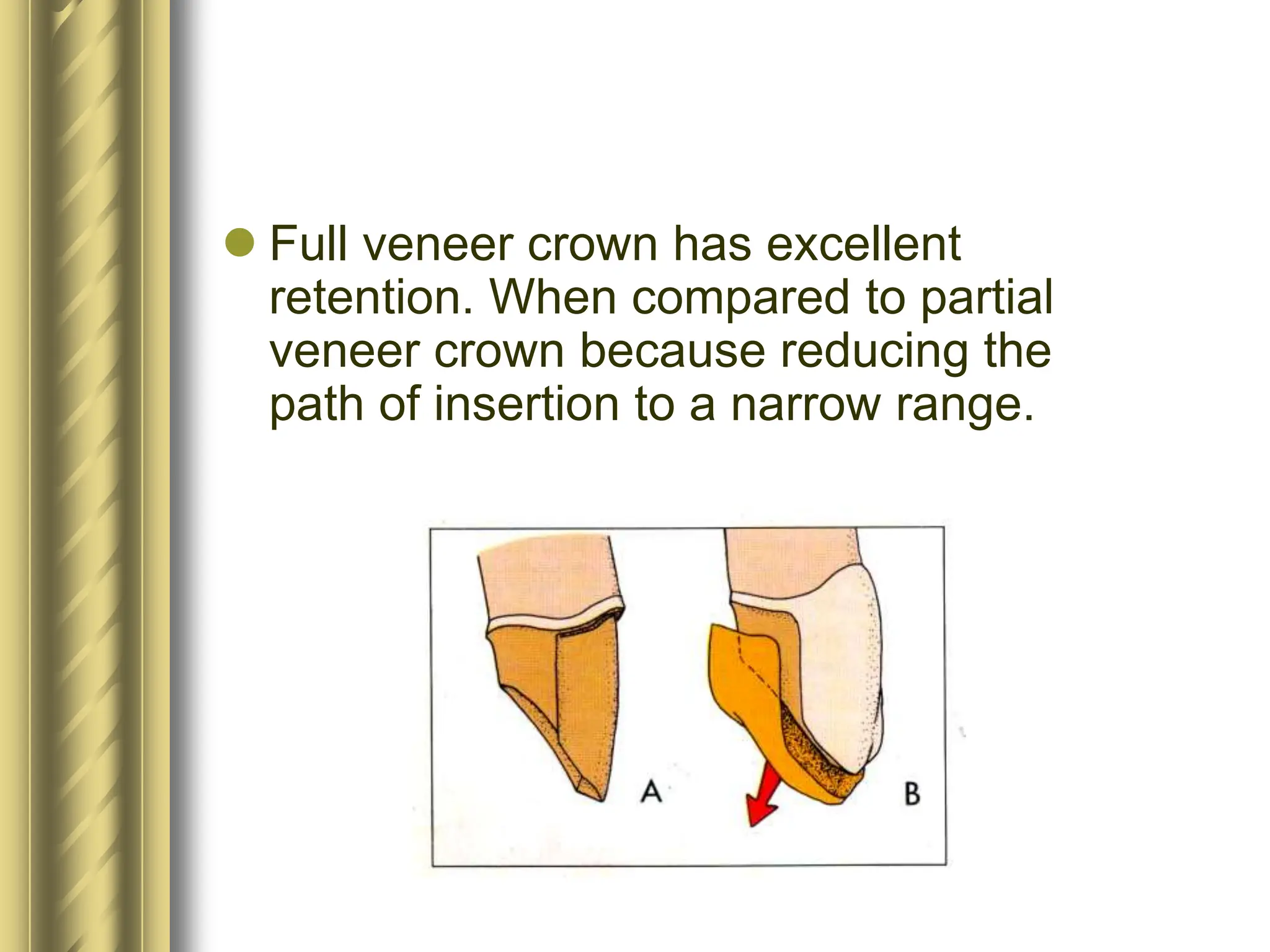 RETENTION AND RESISTANCE FORM in FPD.ppt