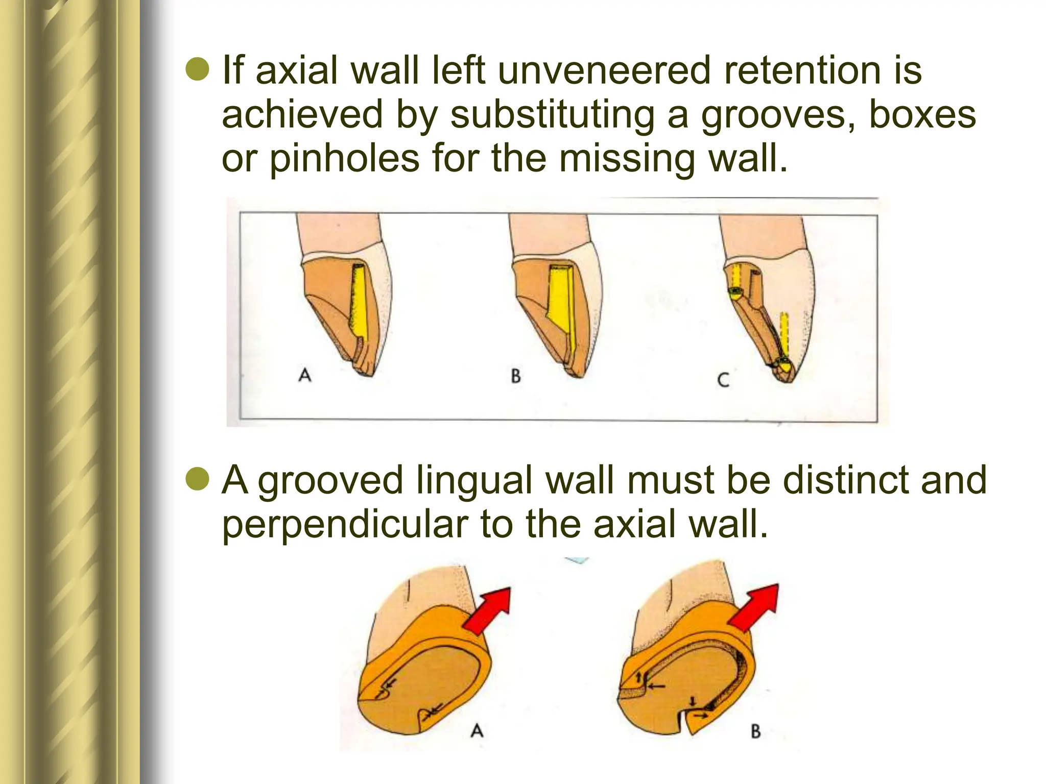 RETENTION AND RESISTANCE FORM in FPD.ppt