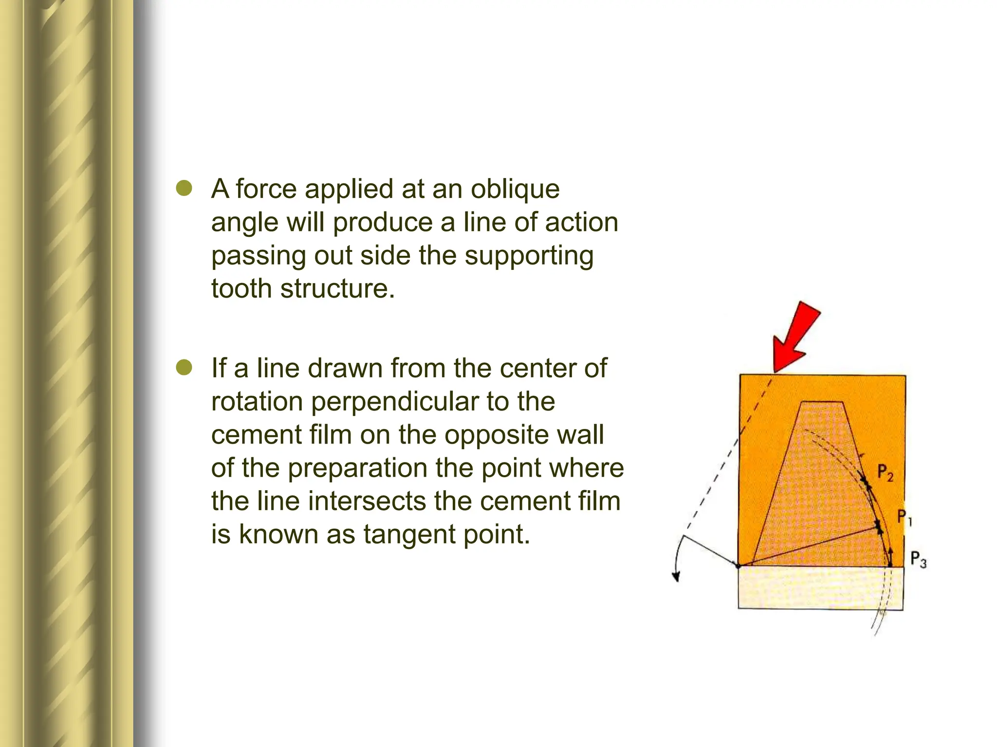 RETENTION AND RESISTANCE FORM in FPD.ppt