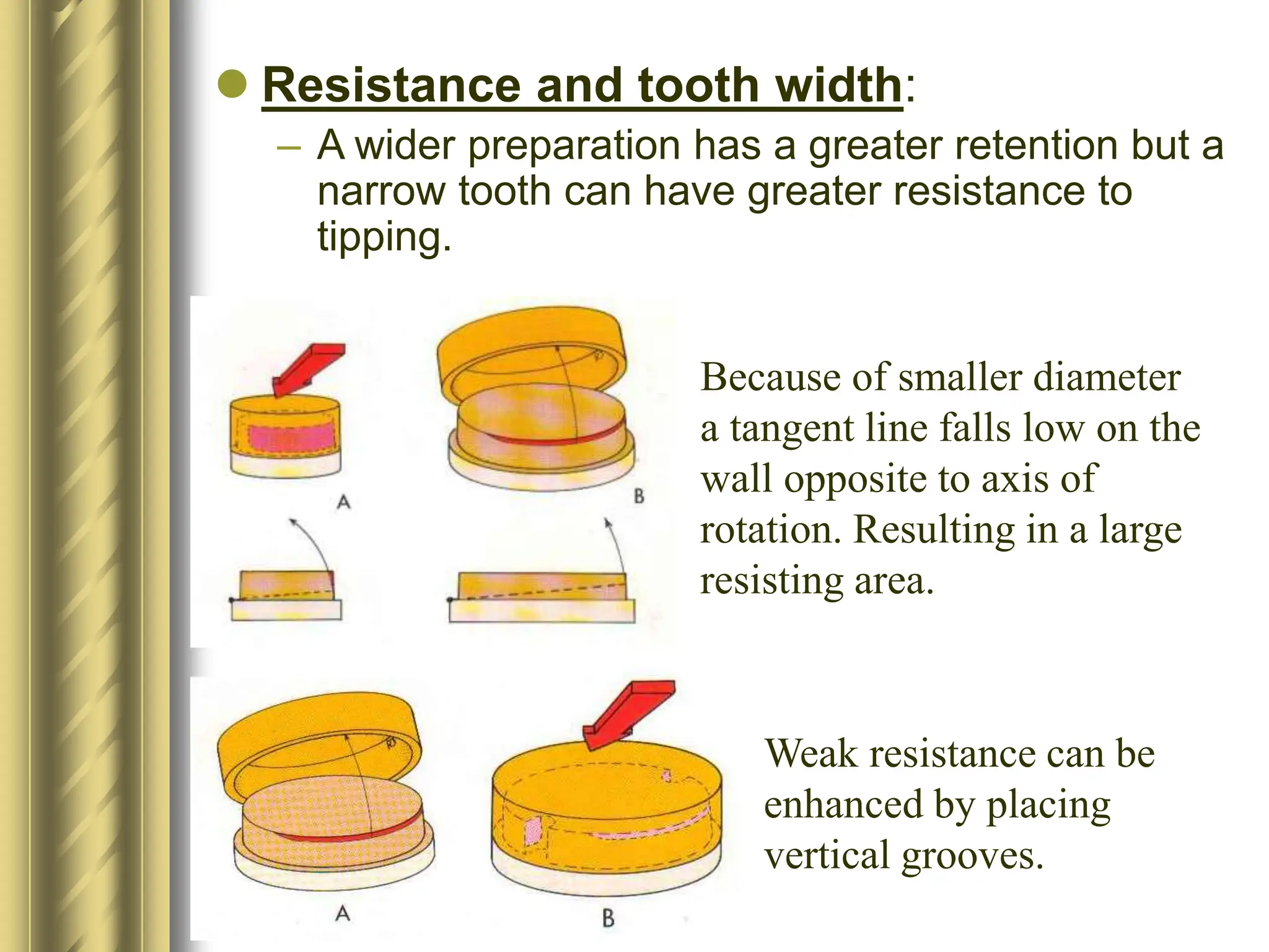RETENTION AND RESISTANCE FORM in FPD.ppt