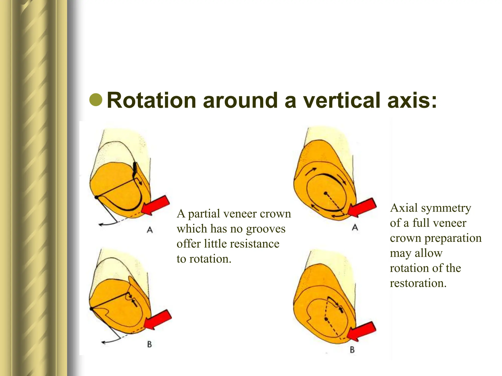 RETENTION AND RESISTANCE FORM in FPD.ppt
