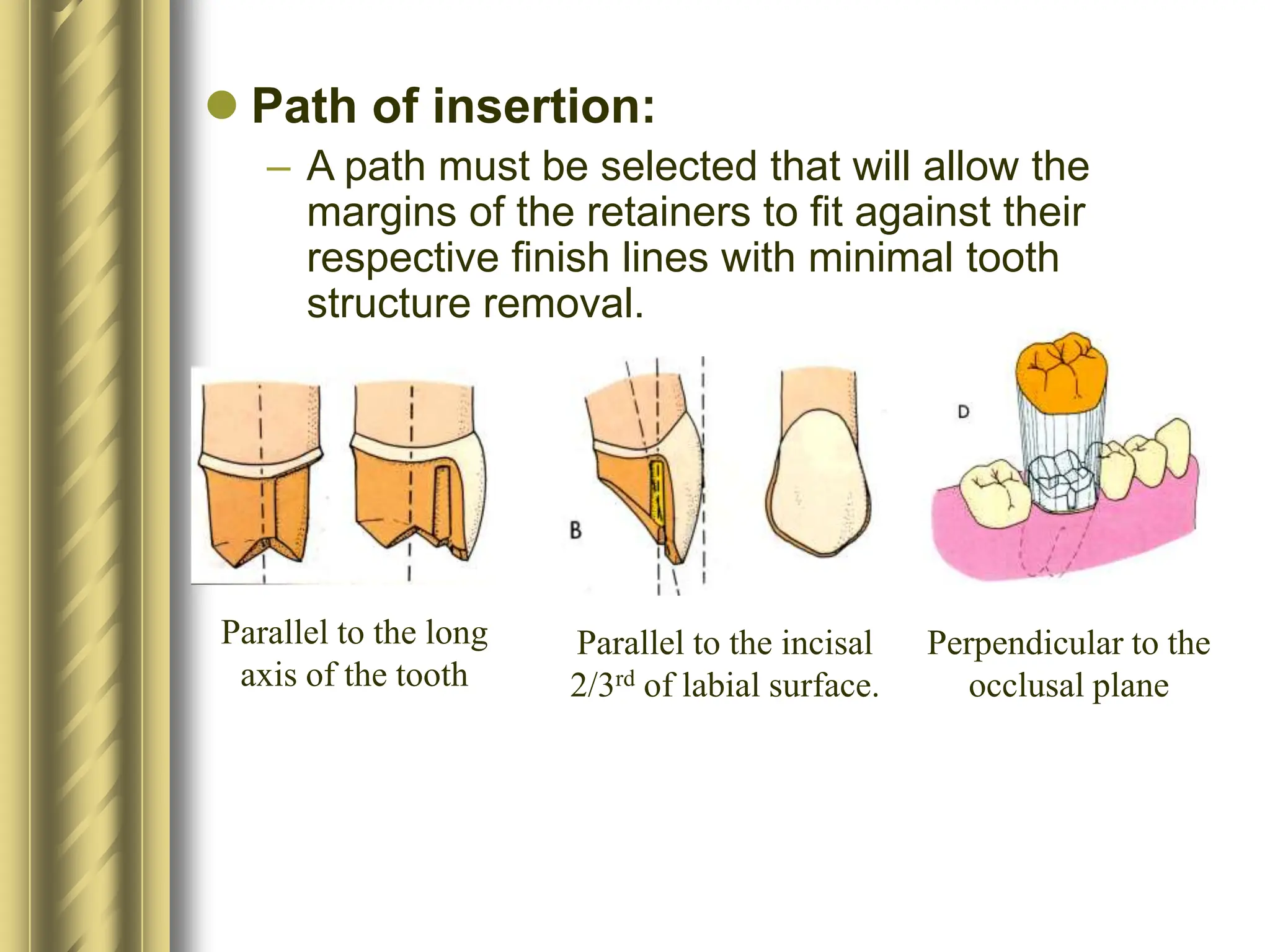 RETENTION AND RESISTANCE FORM in FPD.ppt