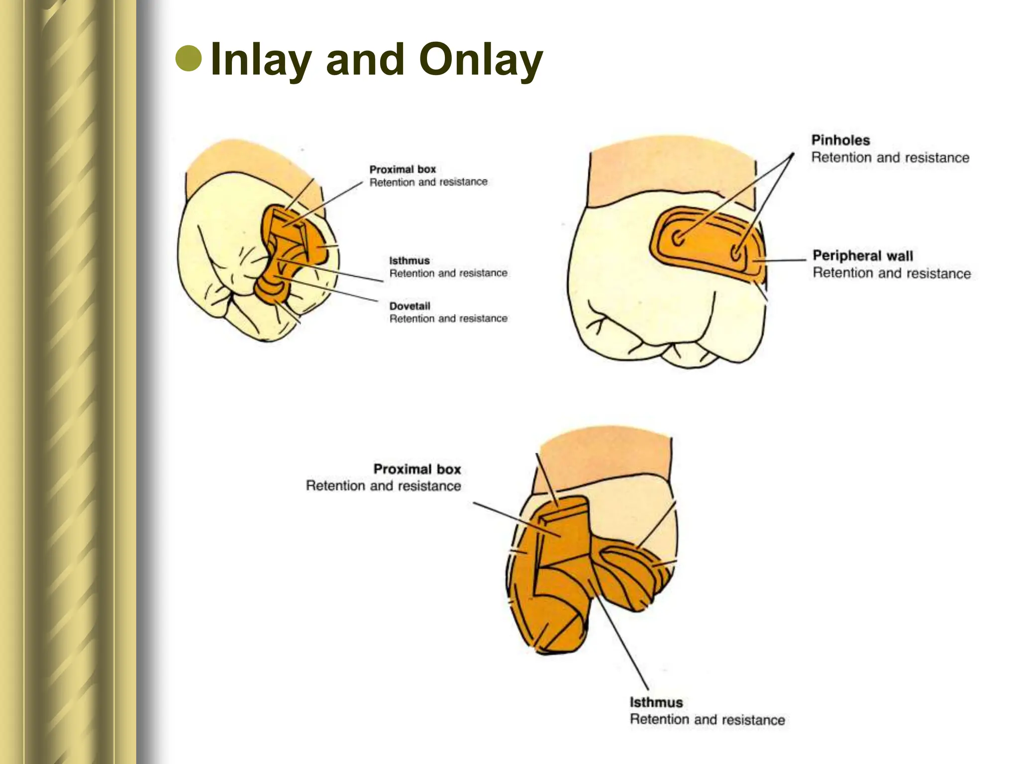 RETENTION AND RESISTANCE FORM in FPD.ppt