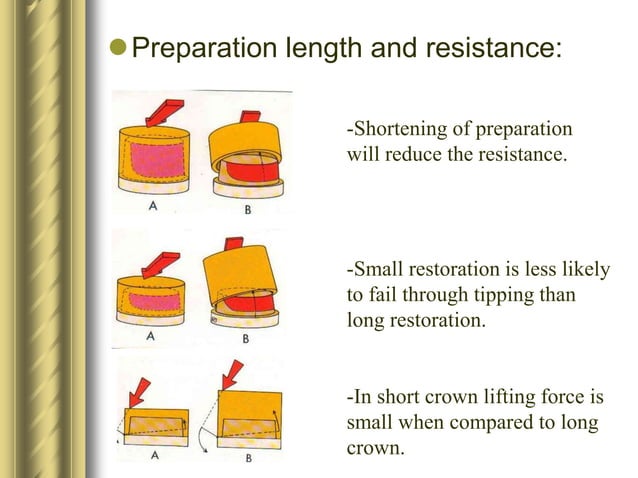 RETENTION AND RESISTANCE FORM in FPD.ppt | Dental Health | Diseases and ...