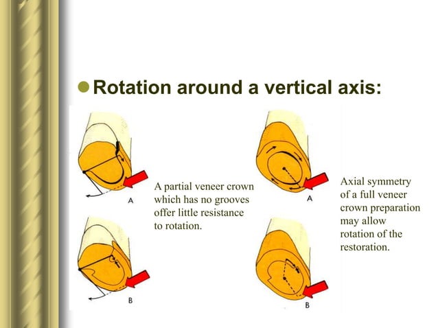 RETENTION AND RESISTANCE FORM in FPD.ppt | Dental Health | Diseases and ...