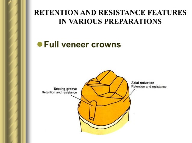 RETENTION AND RESISTANCE FORM in FPD.ppt | Dental Health | Diseases and ...