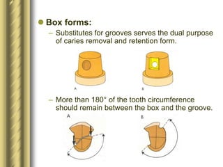 RETENTION AND RESISTANCE FORM in FPD.ppt