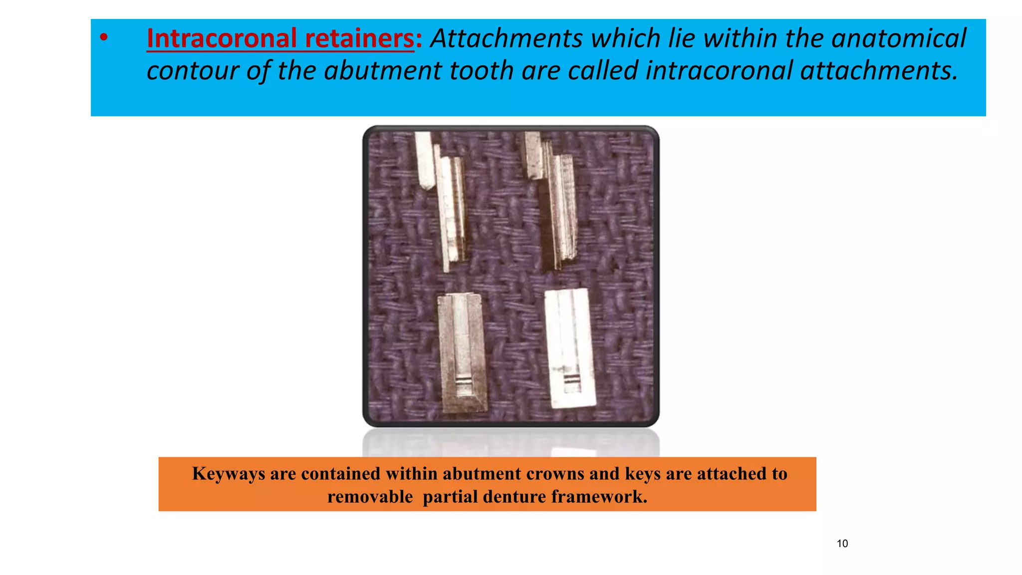 Retention and support in removable partial denture kalpana | PPTX