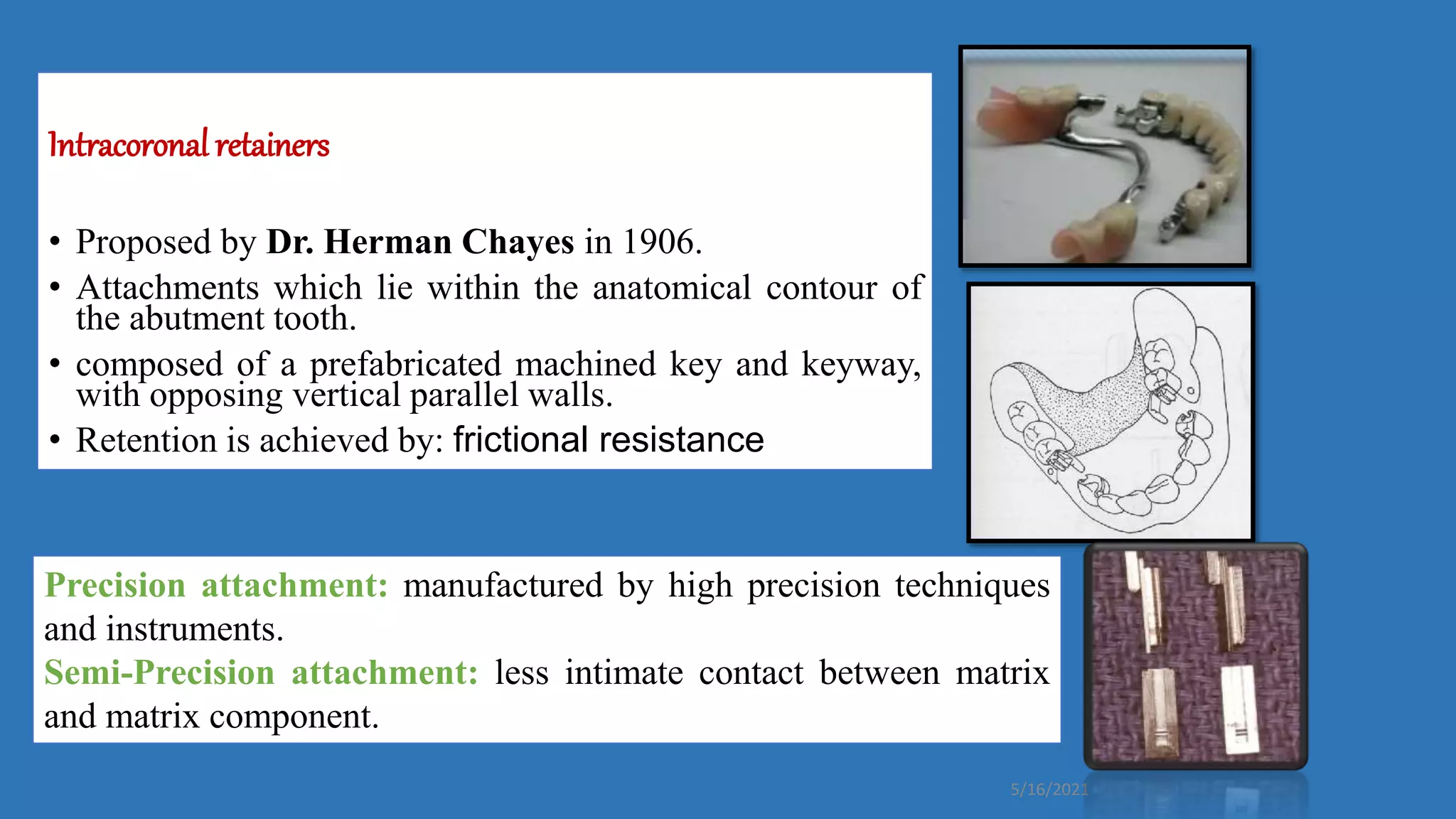 Retention and support in removable partial denture kalpana | PPTX