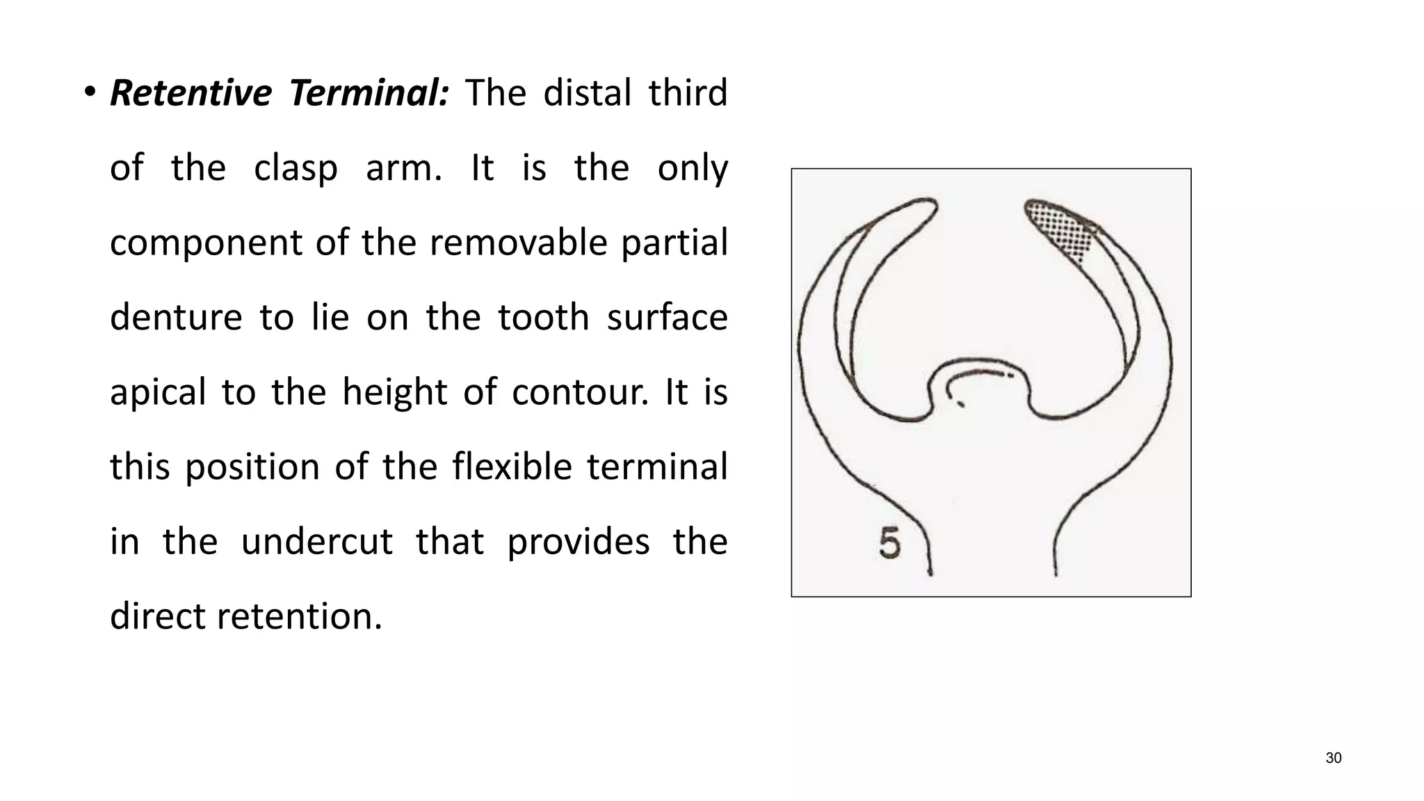 Retention and support in removable partial denture kalpana | PPTX