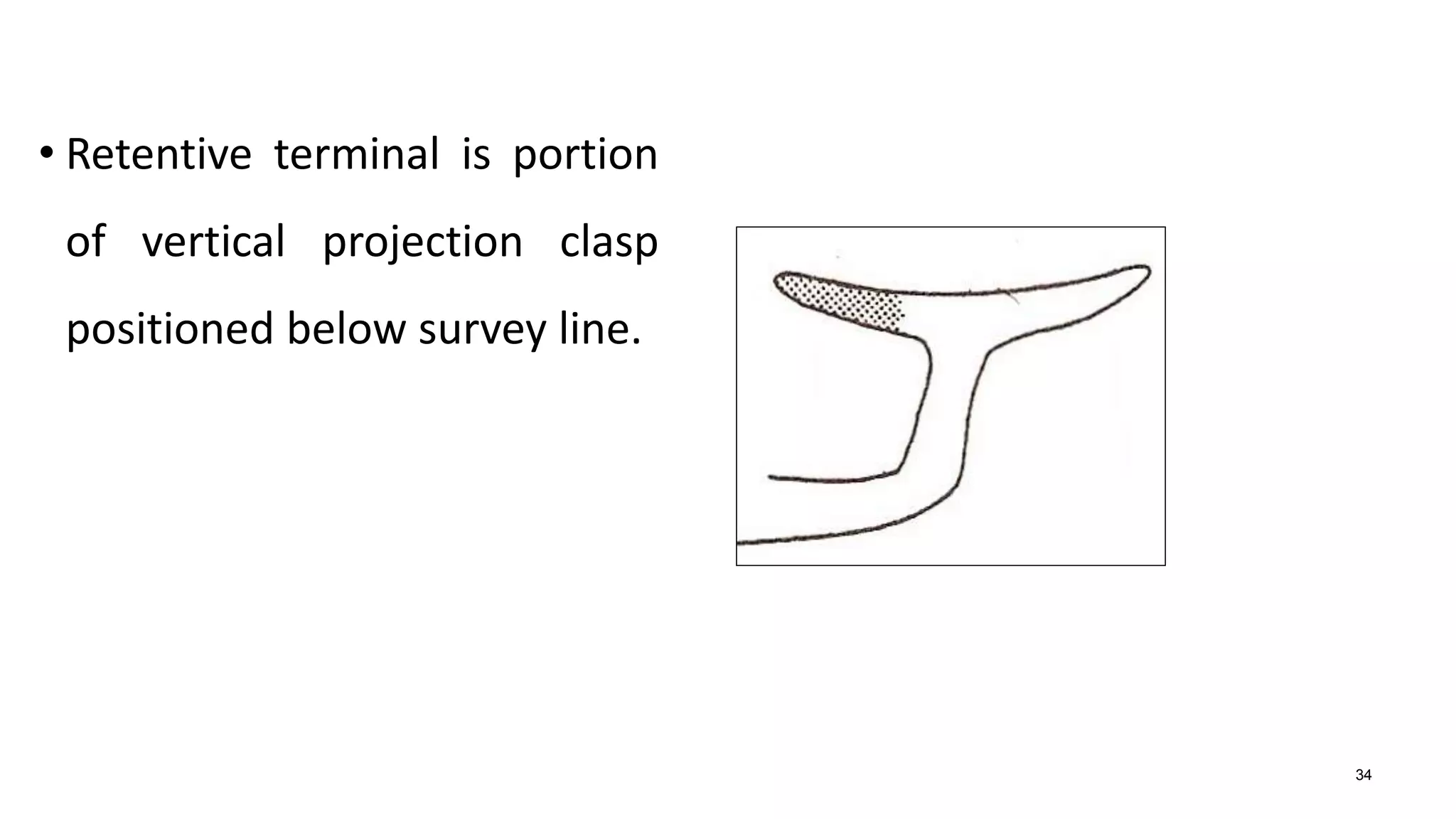 Retention and support in removable partial denture kalpana | PPTX