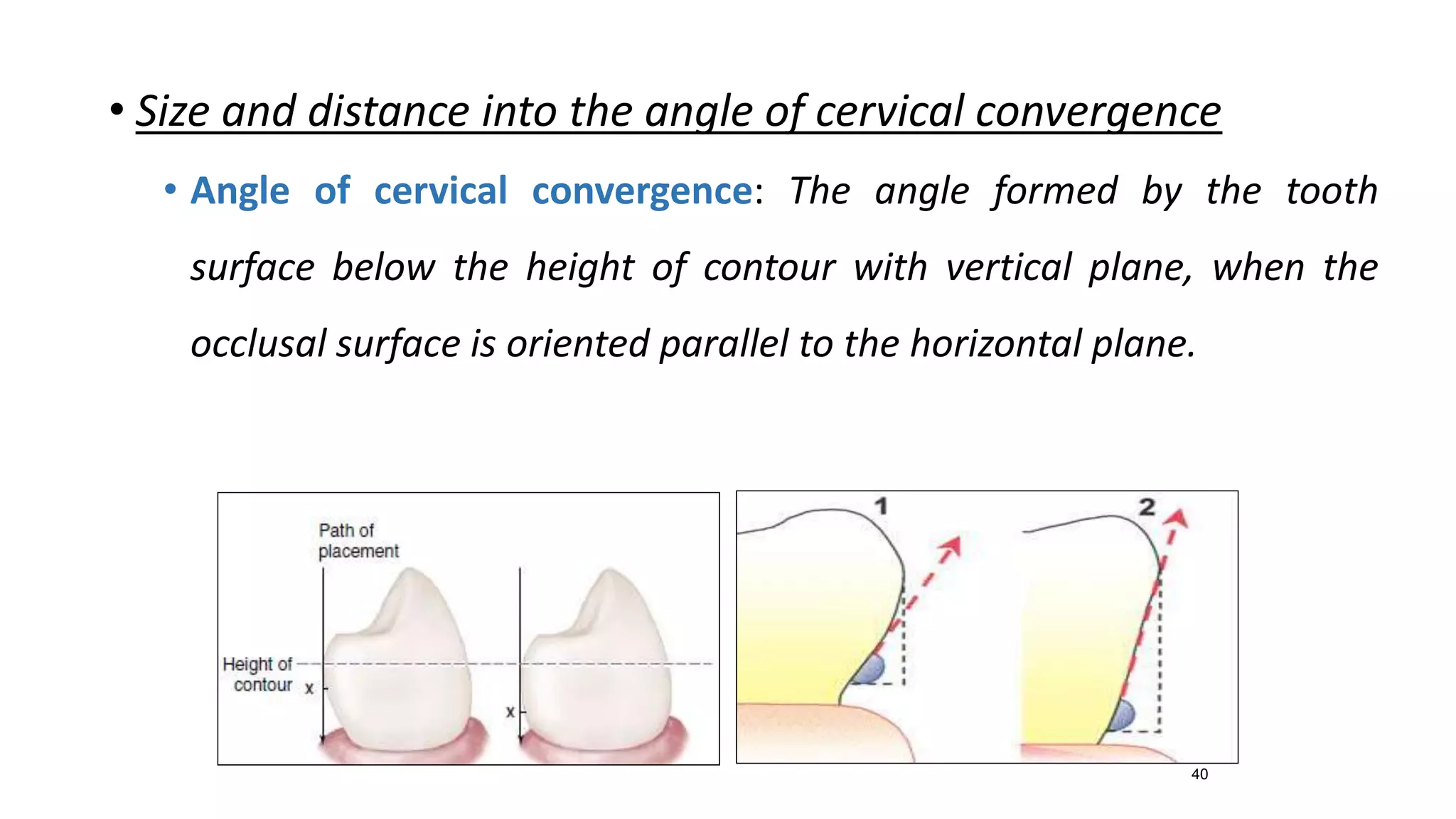 Retention and support in removable partial denture kalpana | PPTX