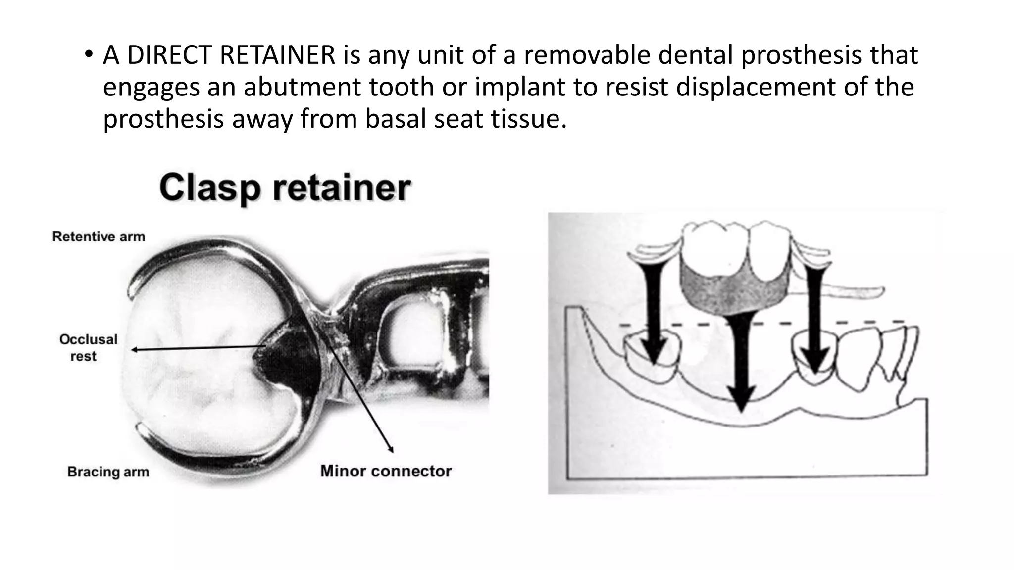 Retention and support in removable partial denture kalpana | PPTX
