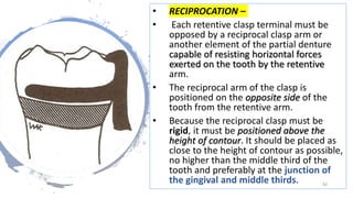 Retention and support in removable partial denture kalpana | PPTX