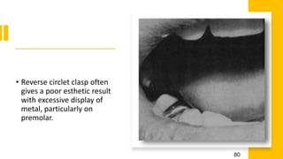 Retention and support in removable partial denture kalpana | PPTX
