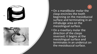 Retention and support in removable partial denture kalpana | PPTX