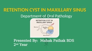 Retentionkkk Cyst in Maxillary Sinus.pptx
